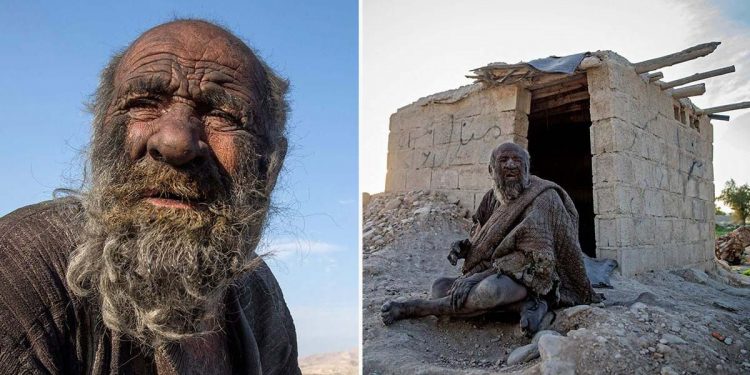 The world's dirtiest man dies after a bath. - Sri Lanka News Update